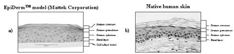 Histology Of A Epiderm Tm Model From Mattek And Download Scientific Diagram