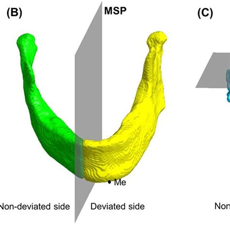 Segmentation Of The Mandible And Lower Facial Soft Tissue A Mandible