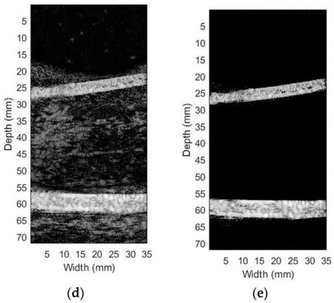 Applied Sciences Special Issue Ultrafast Ultrasound Imaging