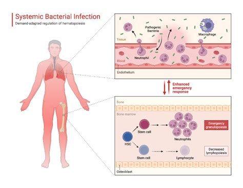 Systemic Bacterial Infection Biorender Science Templates
