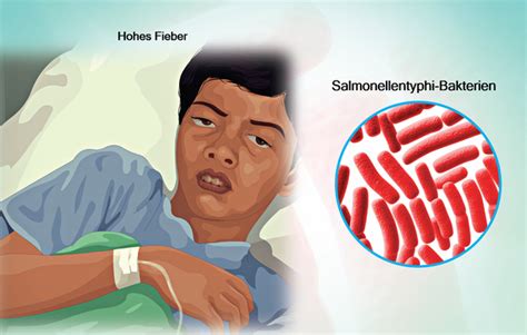 Health Condition Symptoms Causes Treatment And More