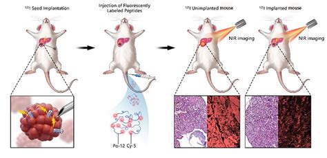 Real Time Monitoring Of Tigit Expression In Hepatocellular Carcinoma For Immunotherapy Guidance