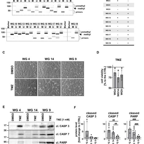 Mgmt Promoter Methylation And The Impact Of Tmz On Primary Glioma Cell Download Scientific