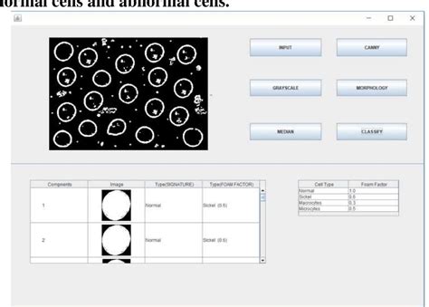 Detecting And Classifying The Cells As Abnormal And Normal