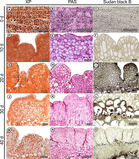 Histochemical Analysis During The Initiation Of The Somatic