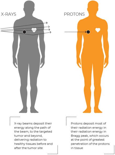 Proton Therapy For Cancer Treatment For African Patients Apollo Proton Cancer Center
