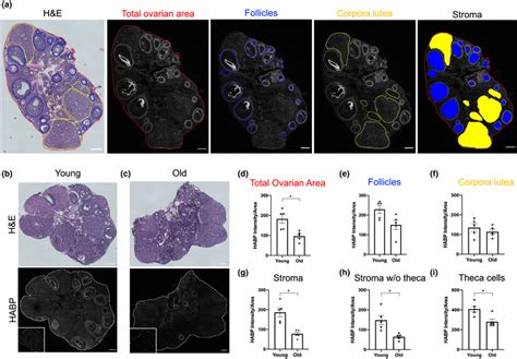 Ha Content Decreases In The Ovarian Stroma And Theca Layer With Download Scientific Diagram