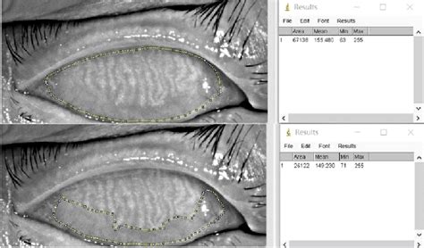 The Semi Automated Imagej Tool Is Used To Draw The Borders Of The Total Download Scientific