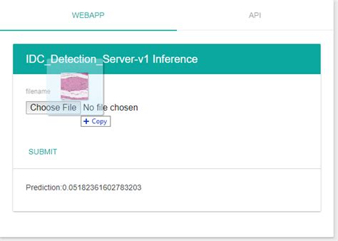 Detecting Breast Cancer With Deep Learning Kdnuggets