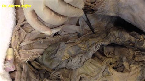 Position Of The Appendix YouTube