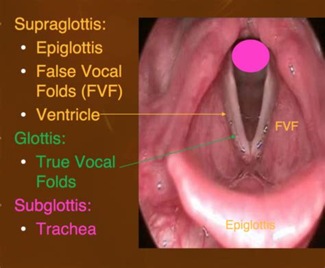 Subglottis