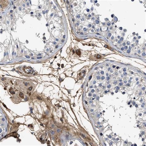 Complement C3 Antibody Pa5 110861