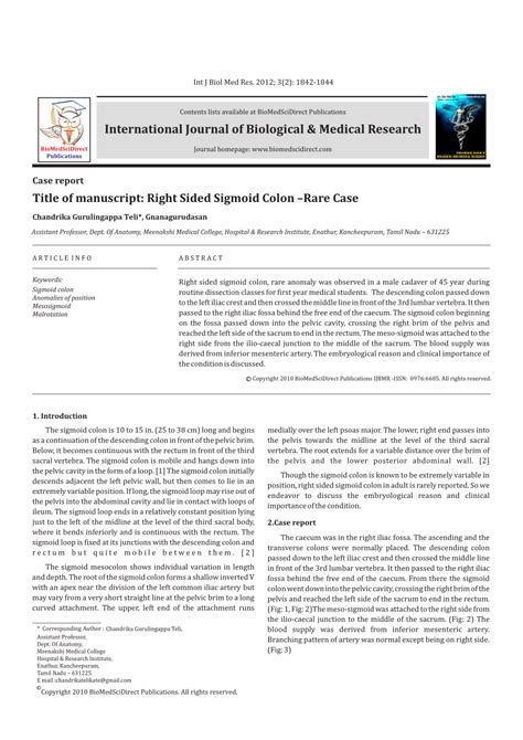 Pdf Right Sided Sigmoid Colon