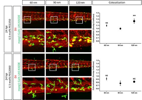 Influence Of Liposome Size And Different Peg Modification On Macrophage