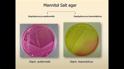 Staphylococcus Haemolyticus A Coagulase Negative Staphylococci Characteristics Diseases