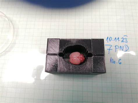 Brain Matrix For Slicing By Daniel Education