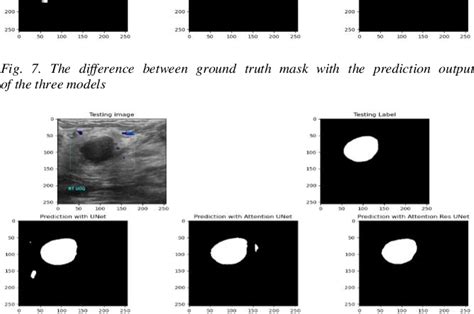 Figure 1 From Segmentation Of Cancer Masses On Breast Ultrasound Images Using Modified U Net