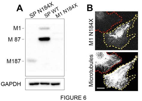 Optimal Kozak Consensus Sequence At M1 N184x Prevents Translation Of