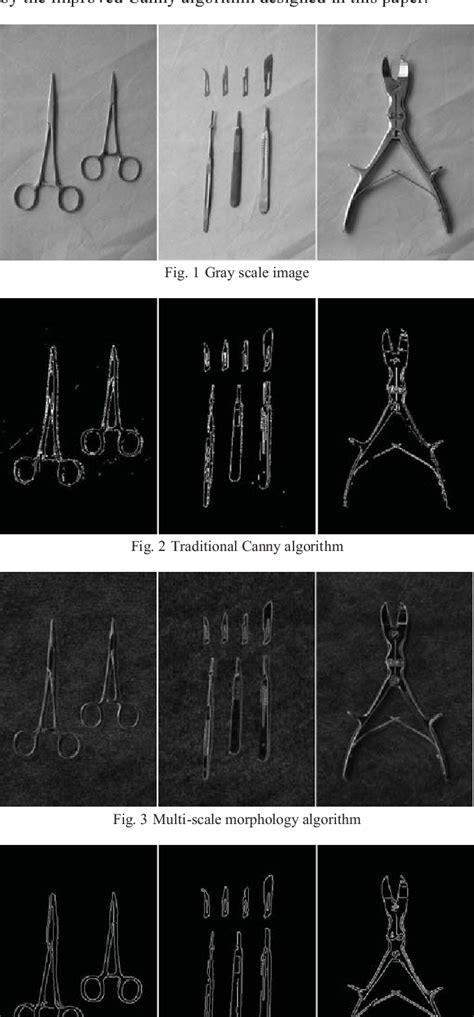 Figure 1 From Application Of Improved Canny Algorithm In Image Of Surgical Instruments