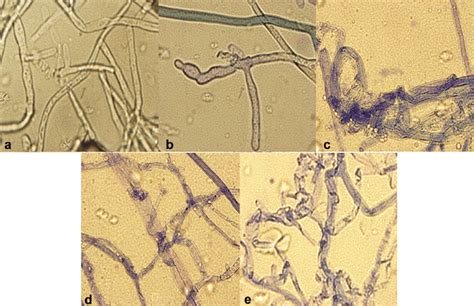Microscopic Observations 100× Of P Ultimum Hyphal Morphology After