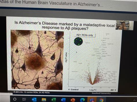 Kit Fuhrman On Linkedin Agbt21 Spatialtranscriptomics