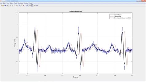 Using MATLAB For Signal Processing Datatas