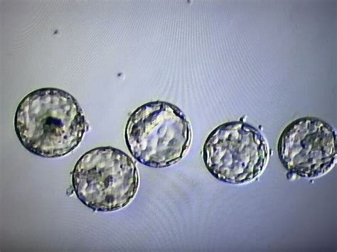 Embryology Blastocyst Ivf Embryologist Reproductivemedicine