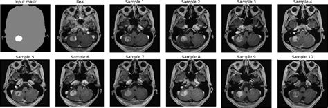 Figure 5 From Conditional Diffusion Models For Semantic 3d Medical