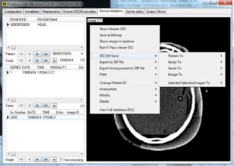 Conquest Dicom Software