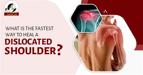 WHAT IS THE FASTEST WAY TO HEAL A DISLOCATED SHOULDER