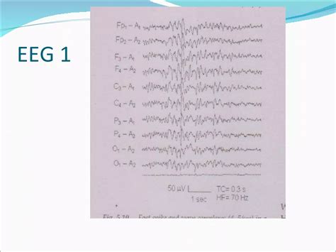 EEG Basics PPT