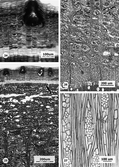 Schefflera Selloi — 24 Phellem With Schizogenous Secretory Cavities