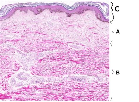 Layers Of Dermis Papillary Reticular
