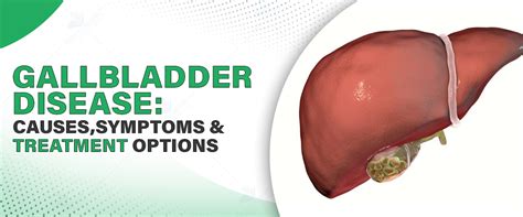 Pcod And Pcos Symptoms Causes Differences And Treatment