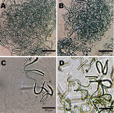 Biofabrication Of Silver Nps Using Nostoc Muscorum Lukesova Ijn