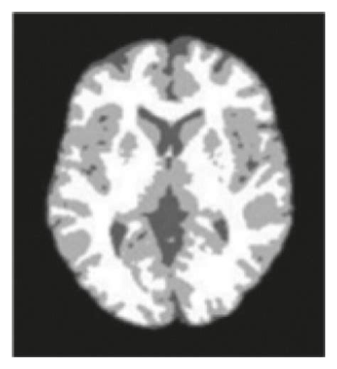 Comparison Of Brain Image Segmentation Effects A Mri Brain Images Download Scientific