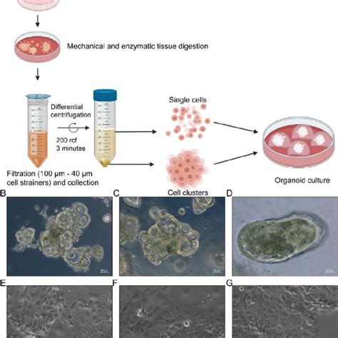 Generation Of Patient Derived Cholangiocarcinoma Cell Lines A Generation Of Patient Derived Cholangiocarcinoma Cell Lines A