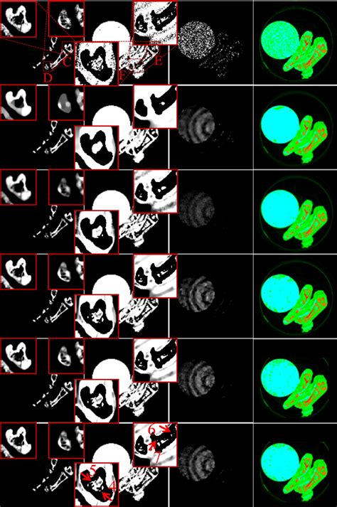 Materials Decomposition Results Of Physical Phantom The 1 St To 4 Th Download Scientific