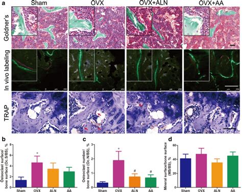 Histomorphometry Of The Trabecular Bone In The Distal Femoral