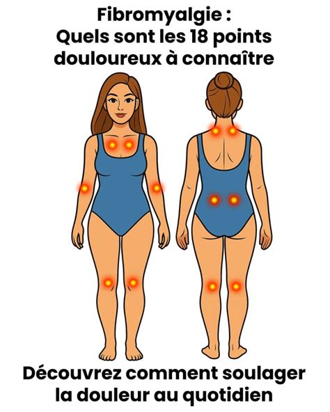 Fibromyalgie Identifier Les Points Douloureux Et Adopter Des Gestes Apaisants Astuces Diy