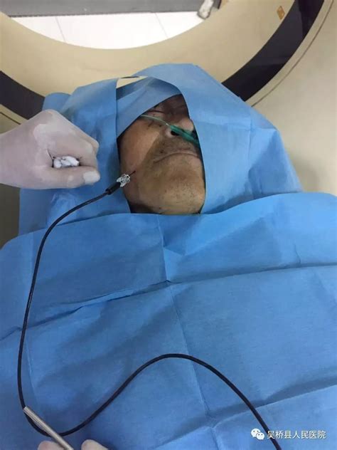 三叉神经痛、痛、痛不停，看我治疗新奇招！