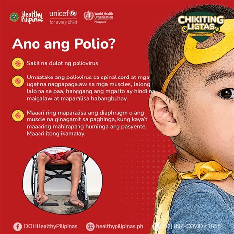 Valenzuela City Ano Nga Ba Ang Polio At Paano Ito Facebook