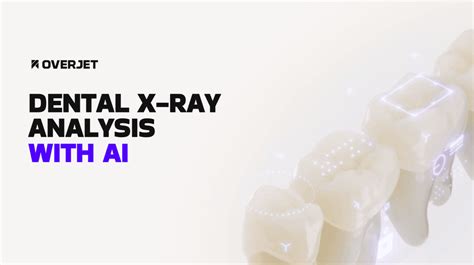 Dental X Ray Ai Analysis Guide How It Works And How To Use It