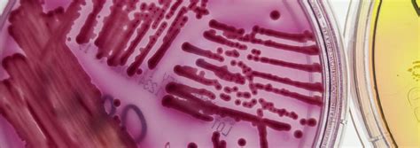 Antimicrobial Resistant Pathogens Program Nyu Langone Health