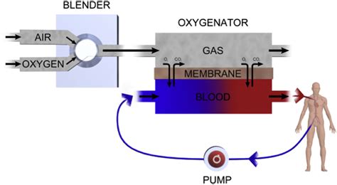 Extracorporeal Membrane Oxygenation For Adult Respiratory Failure Chest