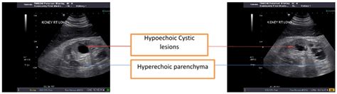 Ijcmcr Cr Id 00928 International Journal Of Clinical Studies