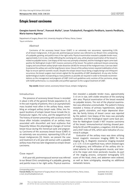 Pdf Ectopic Breast Carcinoma