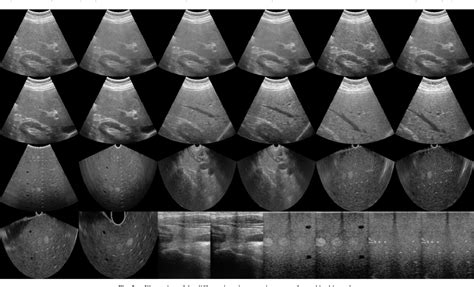 Figure 2 From Principal Component Analysis Based Hybrid Speckle Noise Reduction Technique For