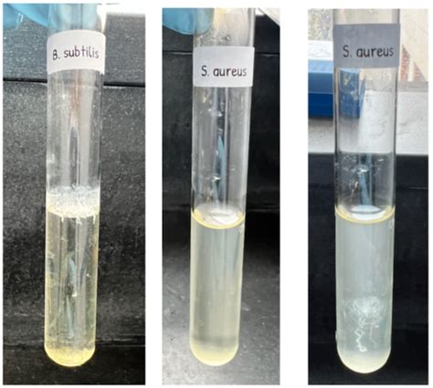 5 Aseptic Technique And Streak Plates Biology Libretexts