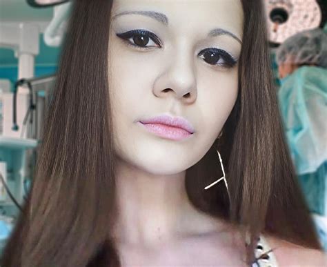 Девушка с самыми большими губами в мире решила увеличить и скулы